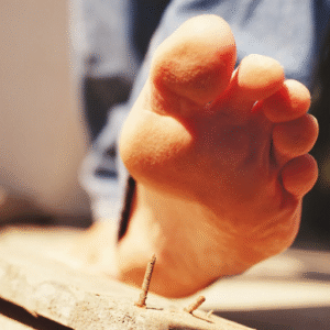 Does Rust Cause Tetanus? Understanding the Risks and Myths - Baetro